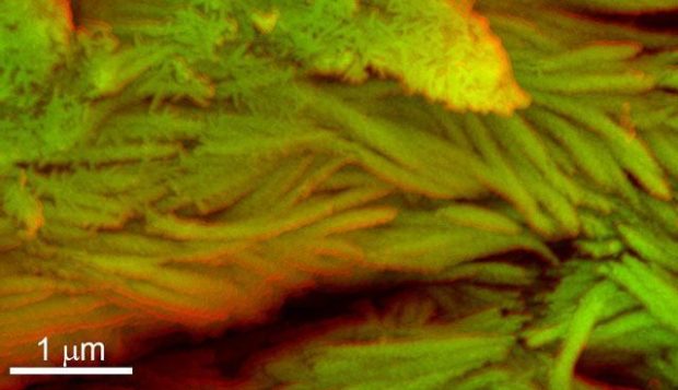 Scientists Believe They Have Found Red Blood Cells in a Dinosaur Fossil ...